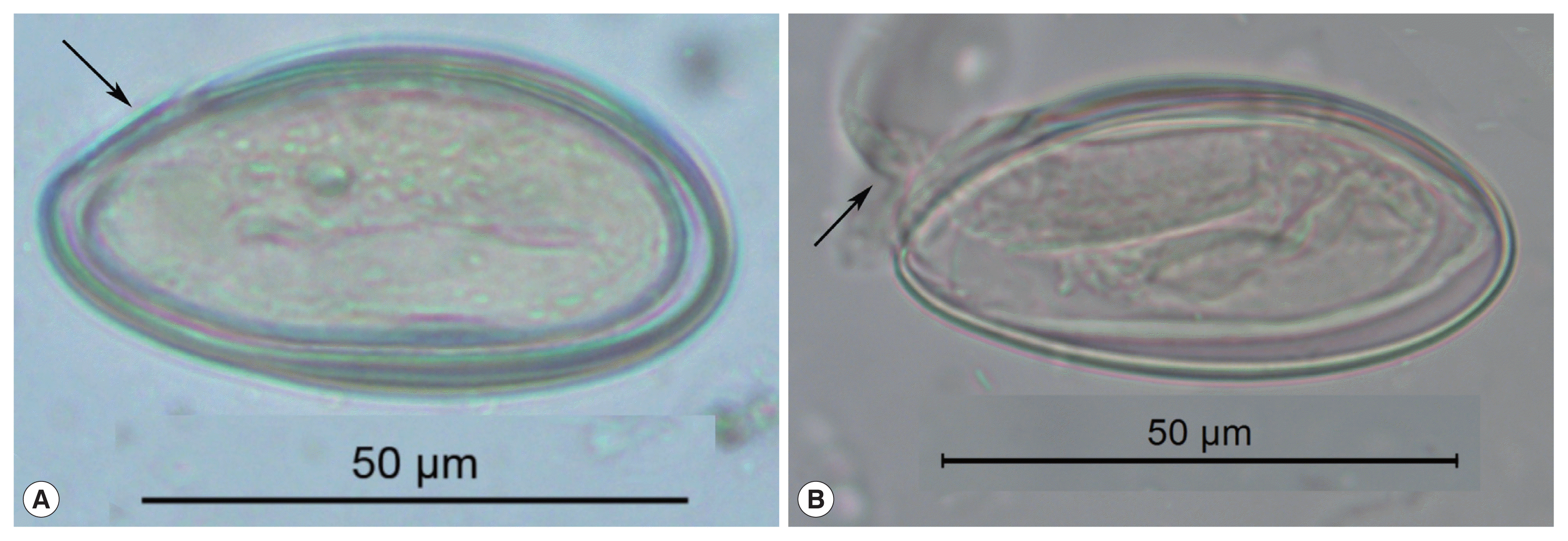 Enterobius Vermicularis Egg 141 Enterobius Vermicularis Stock Photos,